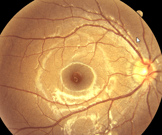 Evergreen Optometry Clinic: Optometrist in Vancouver, BC