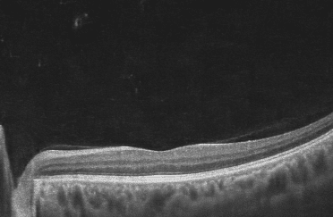 Evergreen Optometry Clinic: Optometrist in Vancouver, BC